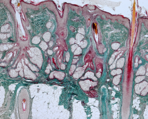 The Intriguing Functions of Hair Explained - medicalmojo